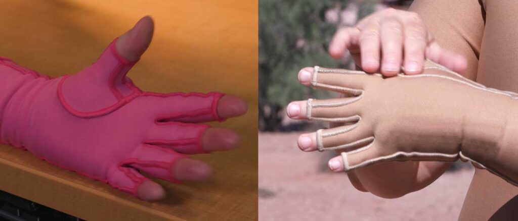 Pressure Garment for Hand | Hand Compression Garment | Bio-Concepts